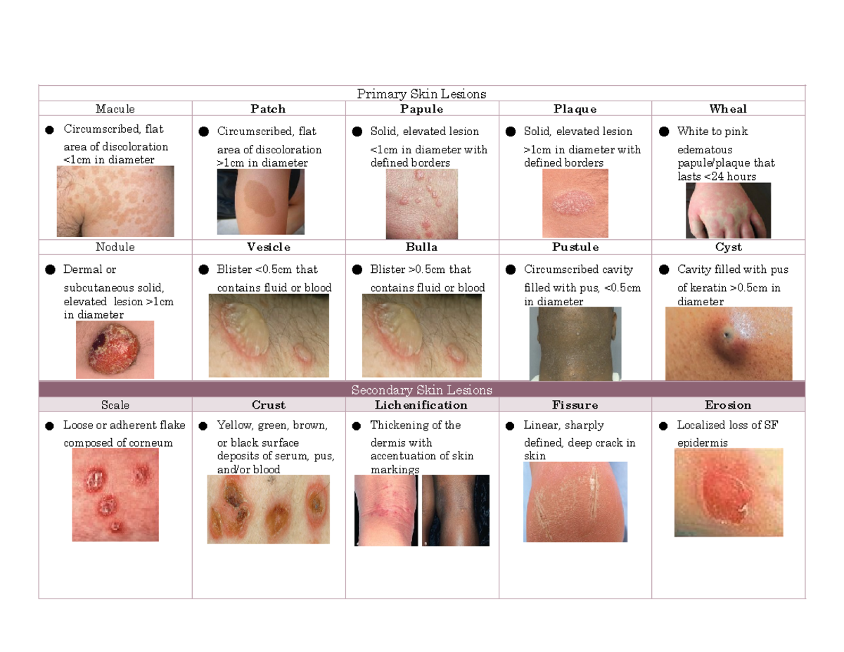 Types Of Skin Lesions Chart