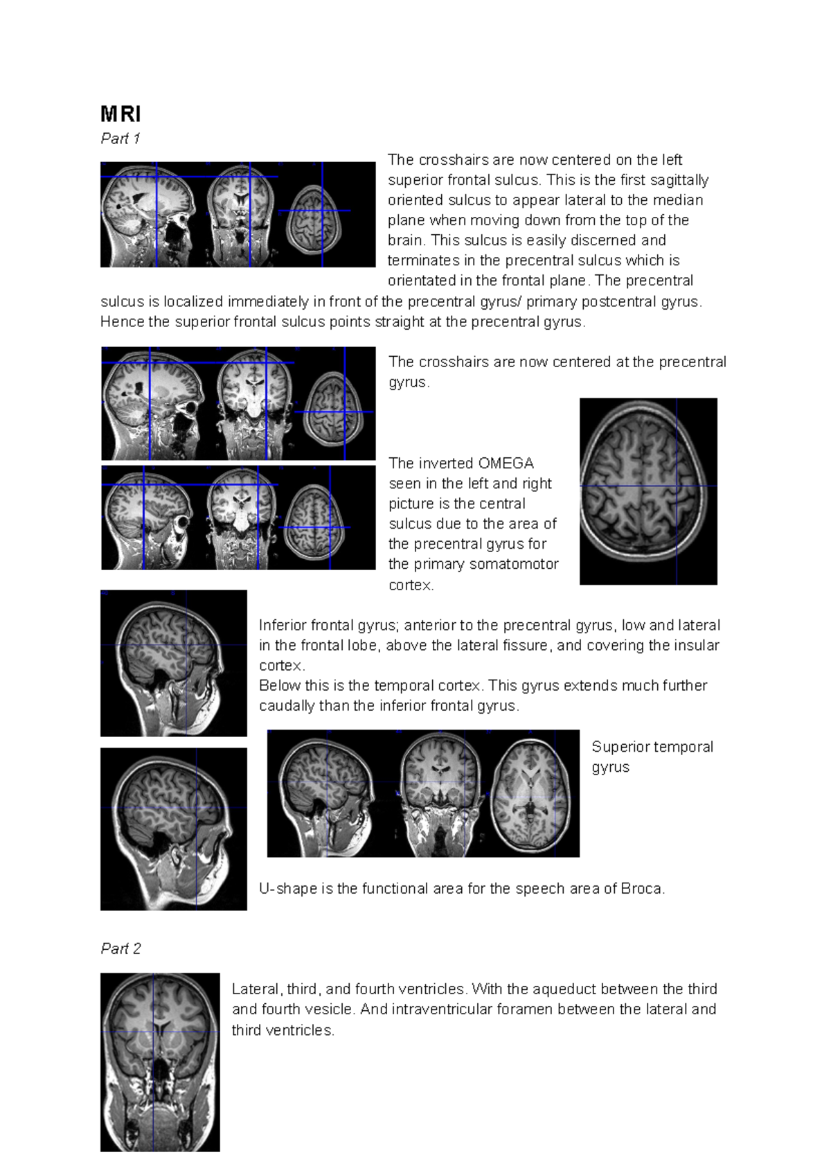 MRI Study Notes: Brain Structure and Function Analysis - Studeersnel