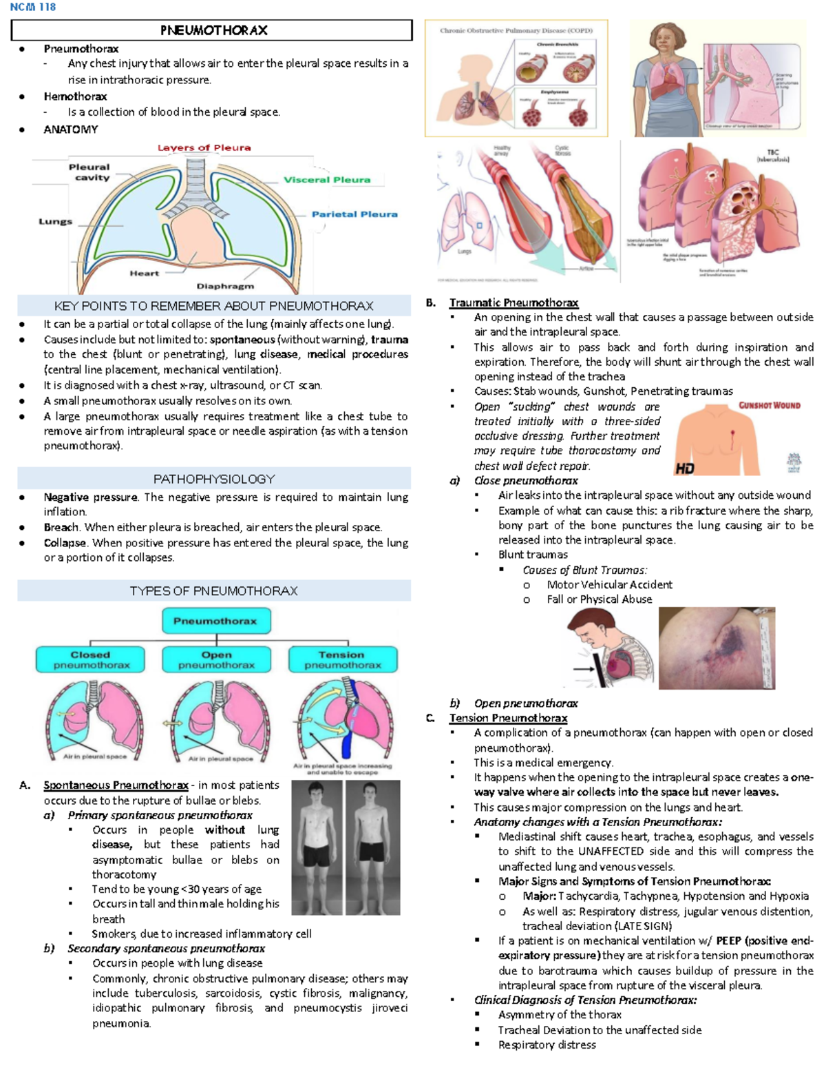 NCM 118 Final Exam Notes on Pneumothorax & ARF/ARDS Concepts - Studocu