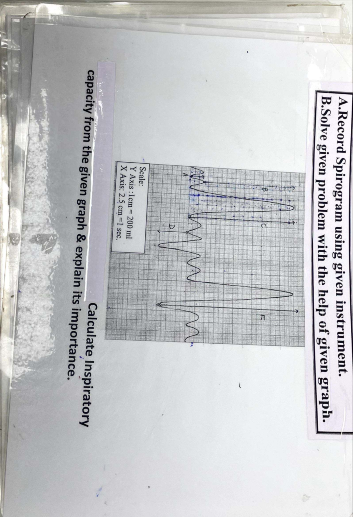 Spirometry Analysis: Vital Capacity & Breathing Metrics - Studocu