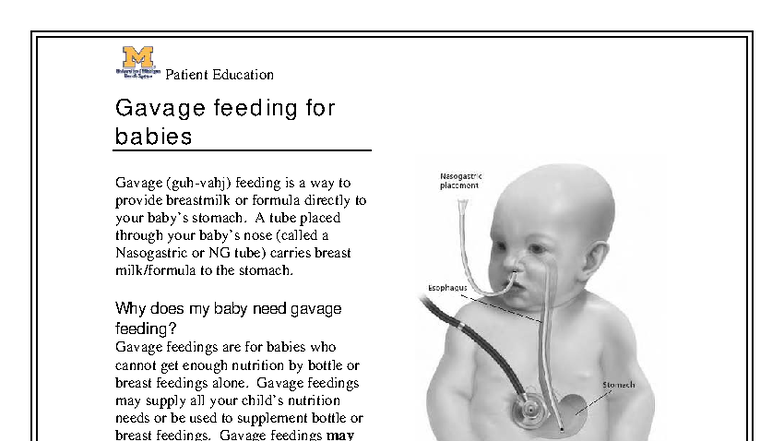 Patient Education: Gavage Feeding for Babies (NG Tube Use) - Studocu