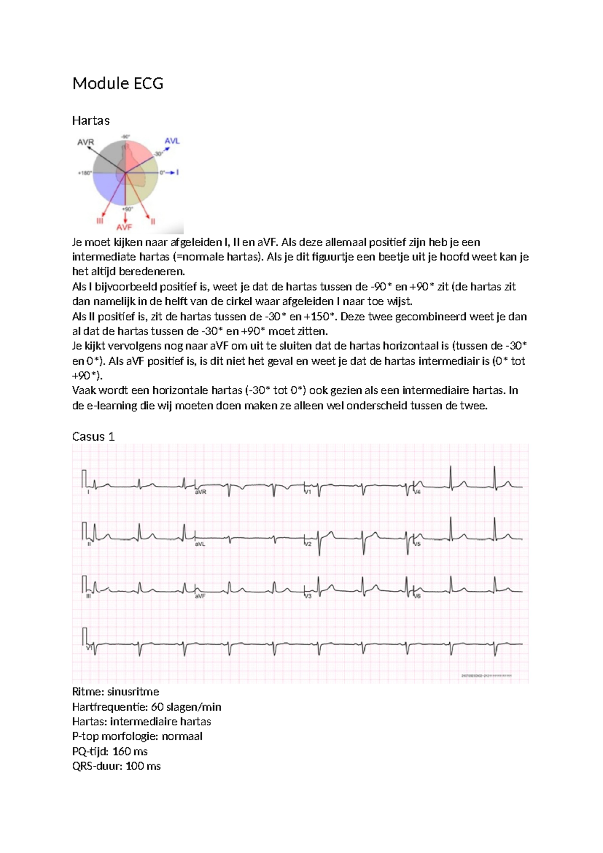 Module ECG: Analyzing Cardiac Axis and Rhythm Cases - Studeersnel
