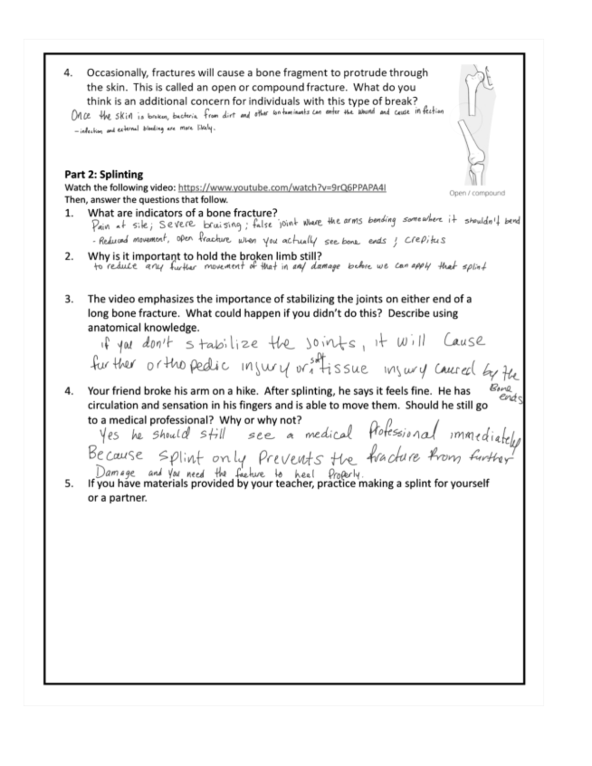 Anatomy - Note - 4. Occasionally, fractures will cause a bone fragment ...