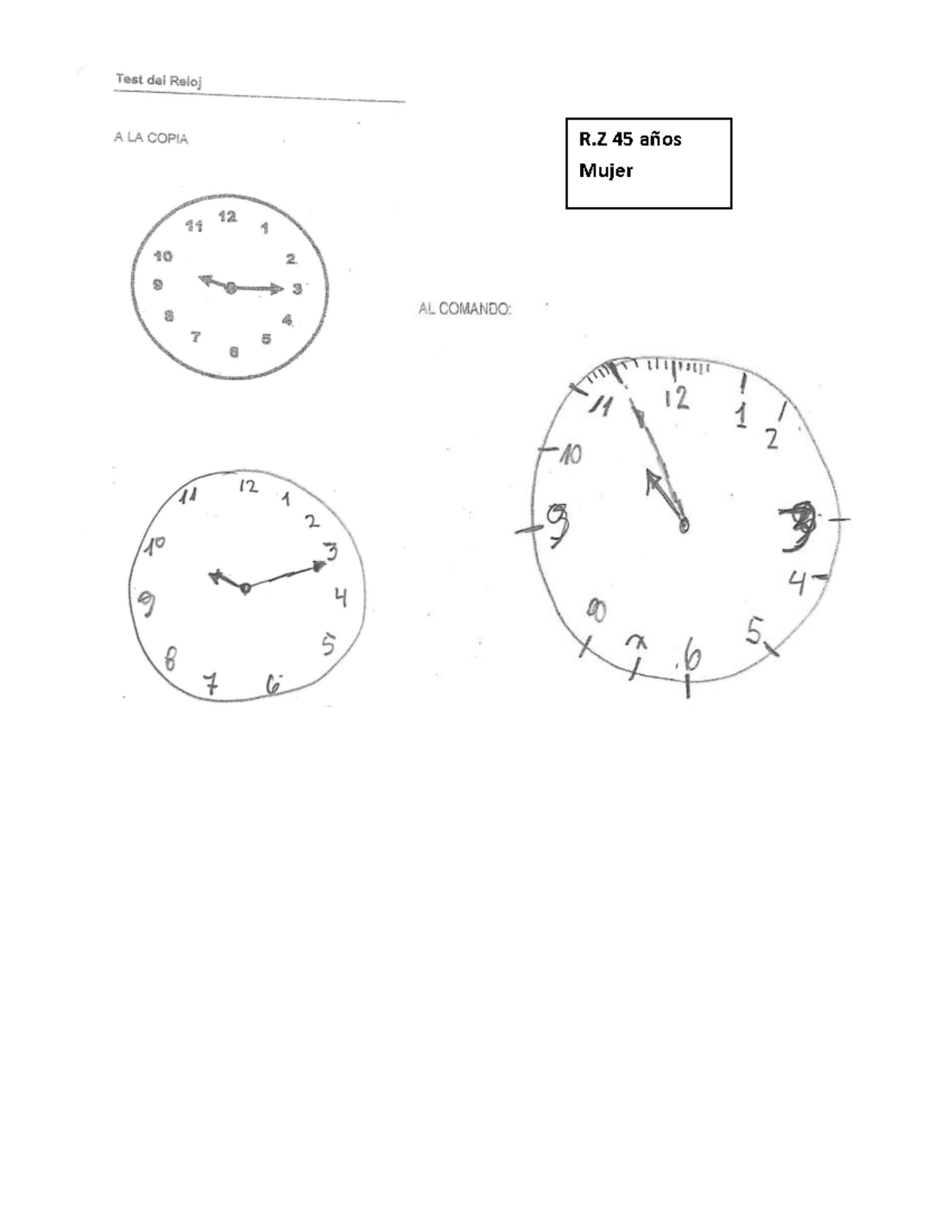 Ejercicios del Test del Reloj: Casos de Administración y Análisis - Studocu