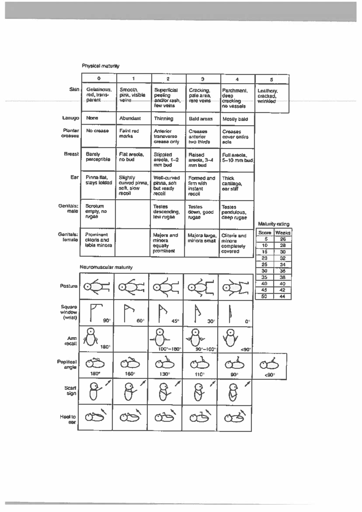 Ballard Score: Assessing Physical & Neuromuscular Maturity - Studocu