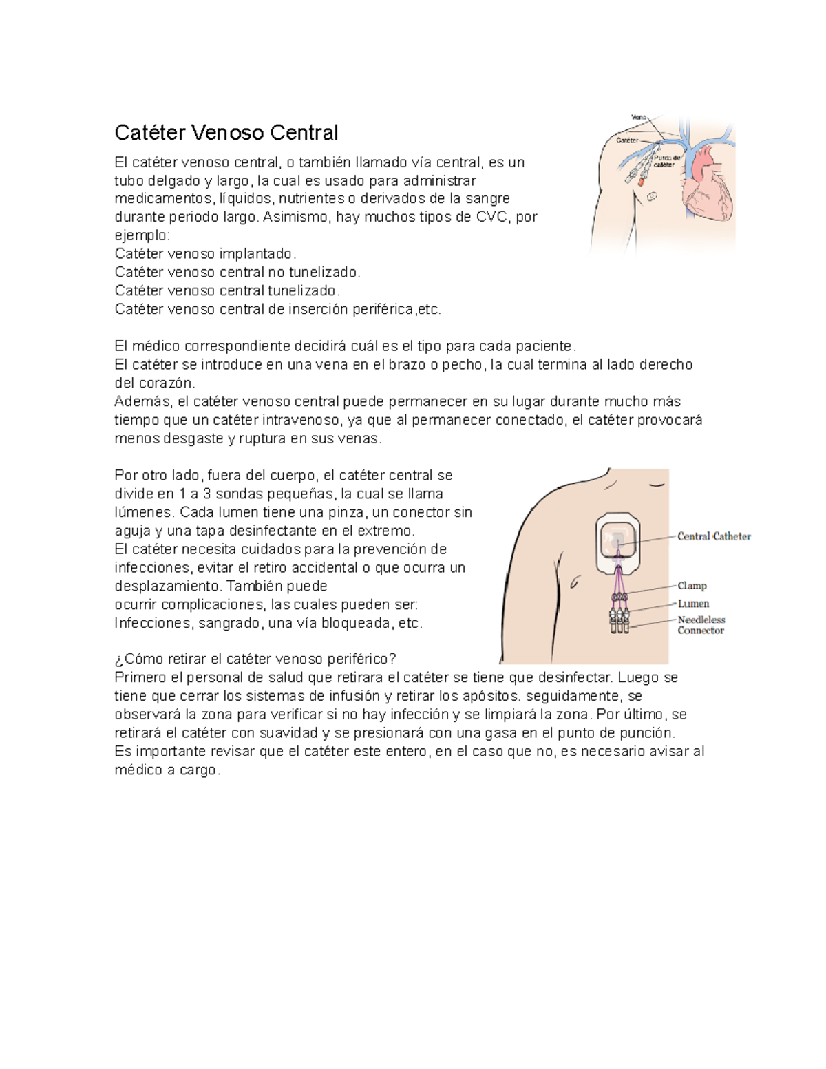 Catéter Venoso Central - Catéter Venoso Central El catéter venoso ...