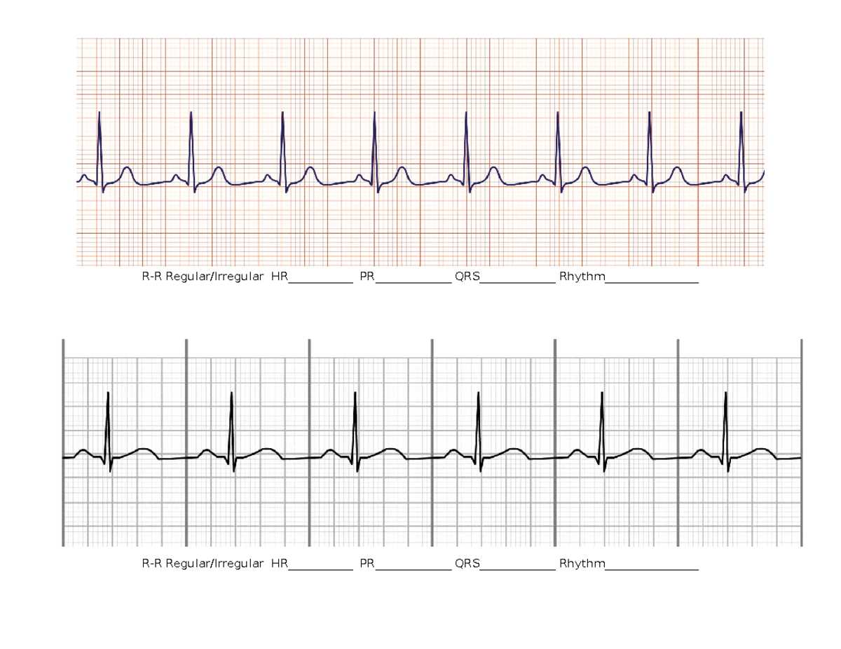 Rhythm Strip Interpretation Practice - NURS S430 - R-R Regular ...
