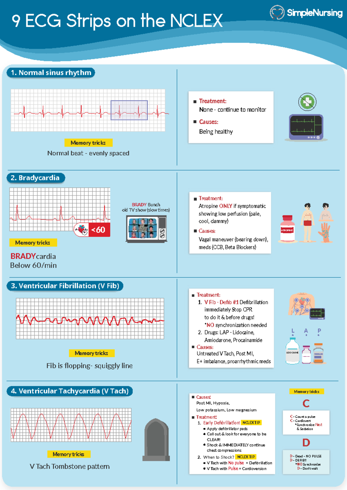 9 Essential ECG Strips for NCLEX Review: Key Treatments & Tips - Studocu