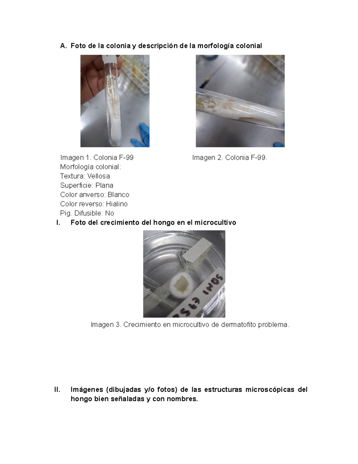 Dermatofito - apuntes - Micología medica - A. Foto de la colonia y ...