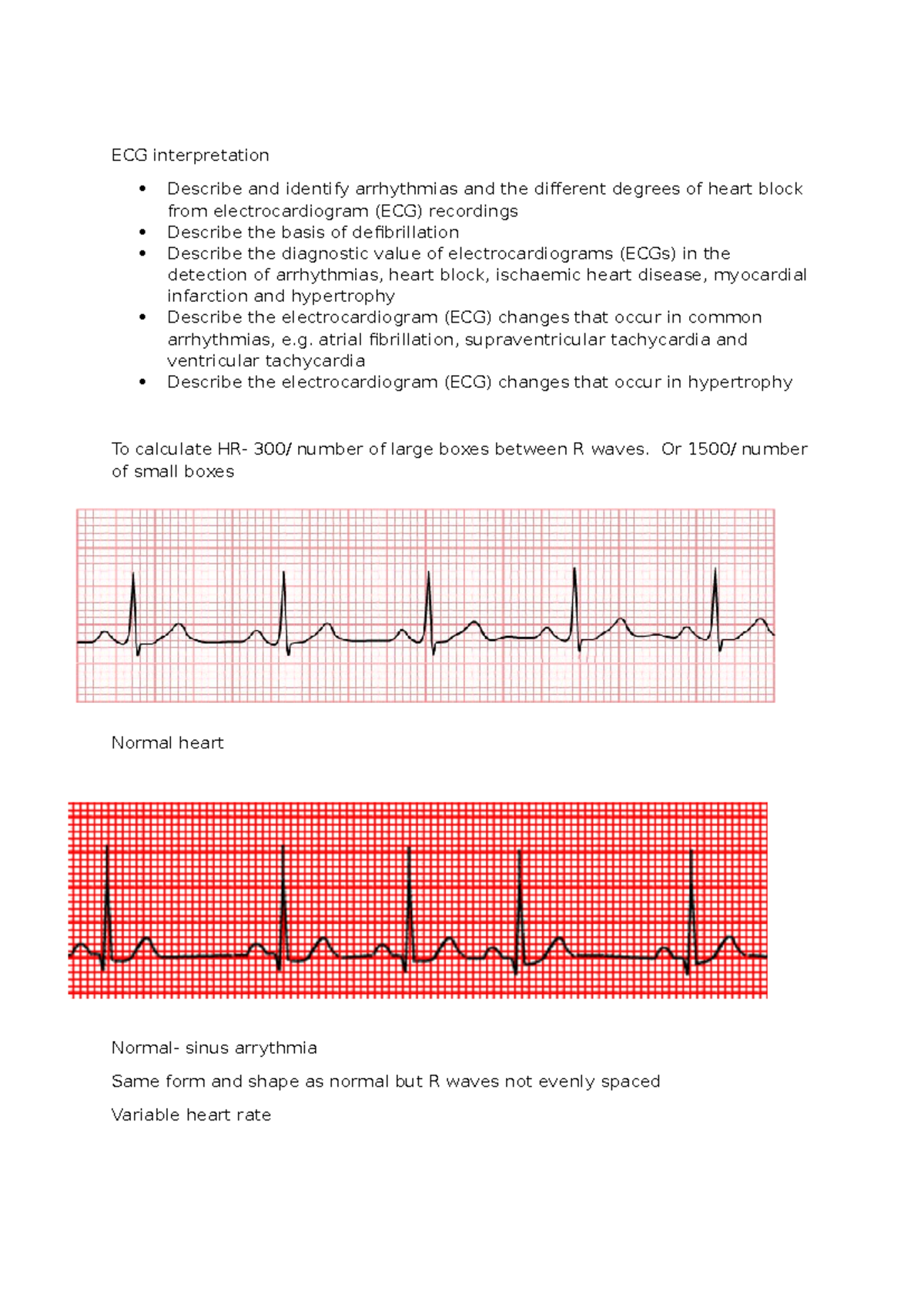 ECG Interpretation Notes - Arrhythmias, Heart Blocks & Emergency Care ...