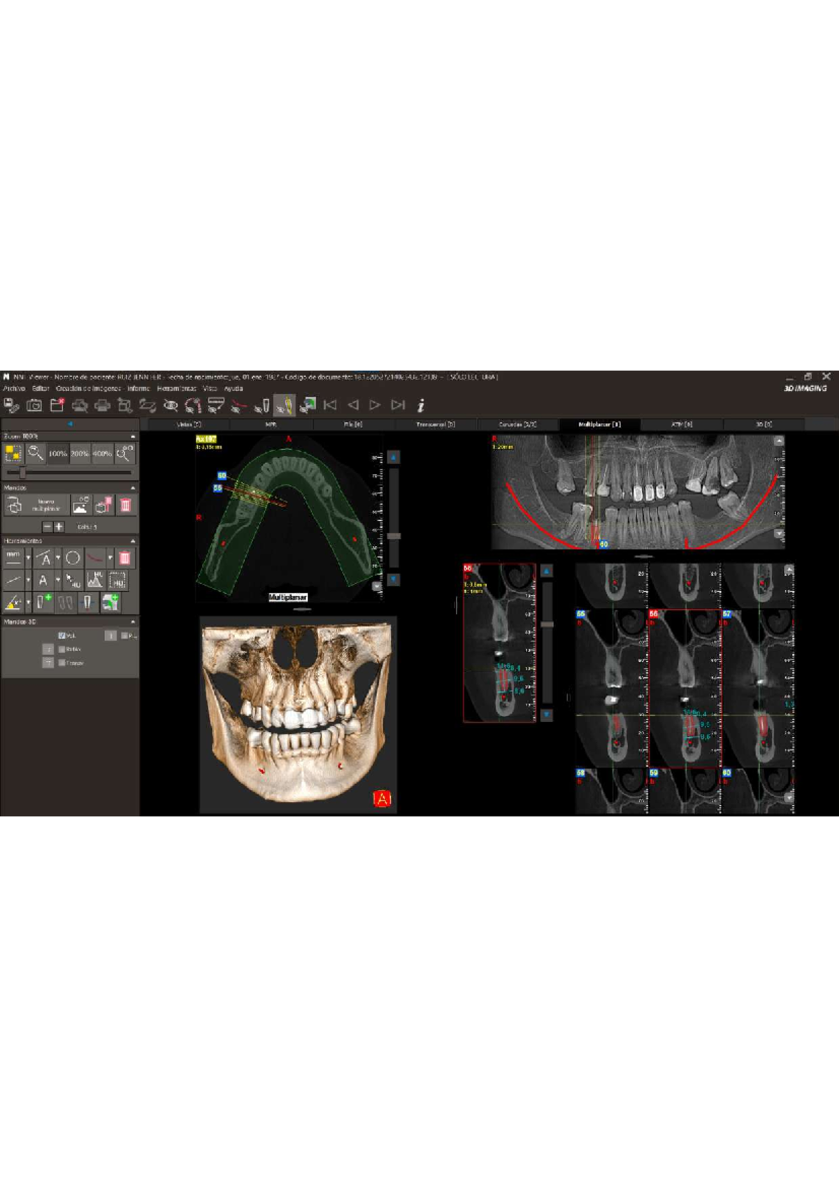 Odontologia Digital-Luis Acosta - Signos Vitales - N NNT Viewer Nombre ...