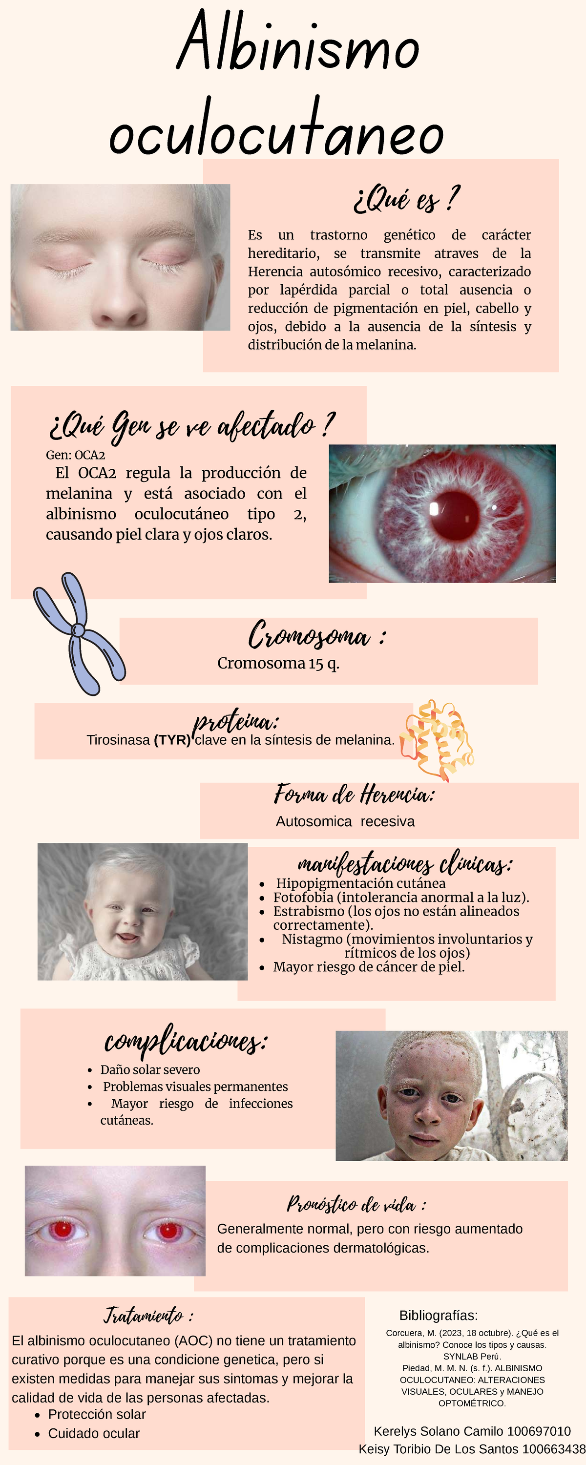 Albinismo oculocutáneo: características, herencia y manejo clínico ...
