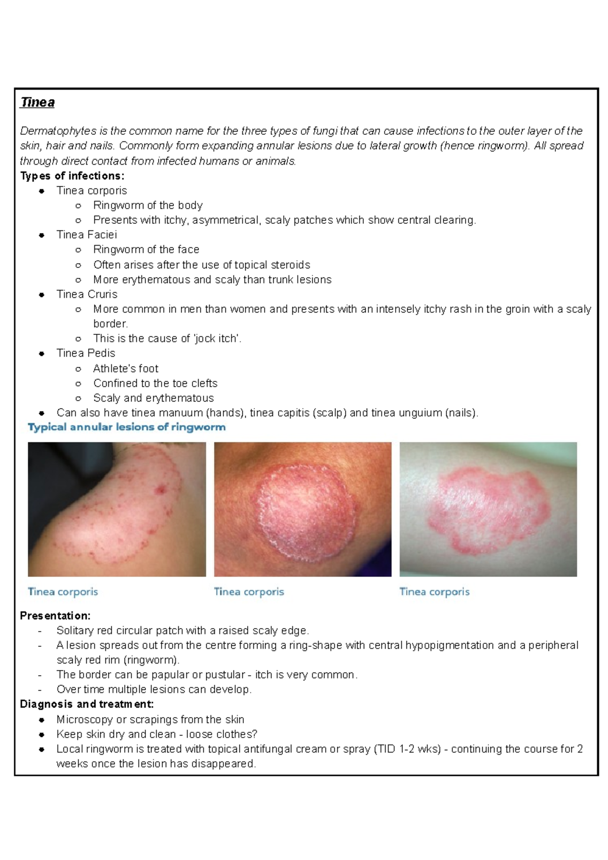 Fungal Skin Infections: Understanding Tinea and Nail Infections - Studocu