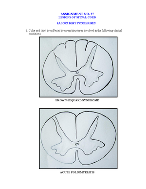 Laboratory Exercise (Dysfuncion of Cerebral Cortex) - ASSIGNMENT NO. 28 ...