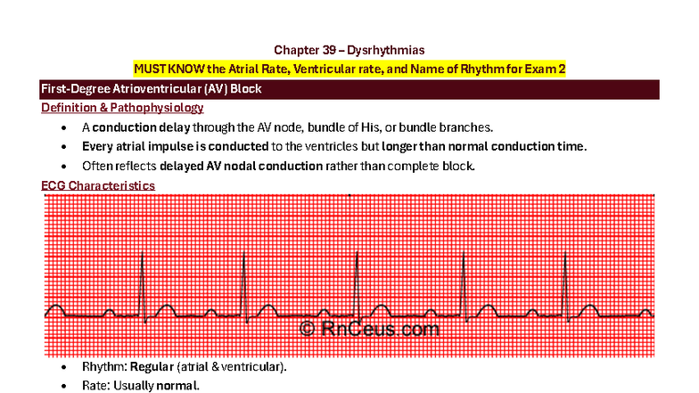 Chapter 39 - Atrioventricular (AV) Blocks Overview for Exam 2 - Studocu