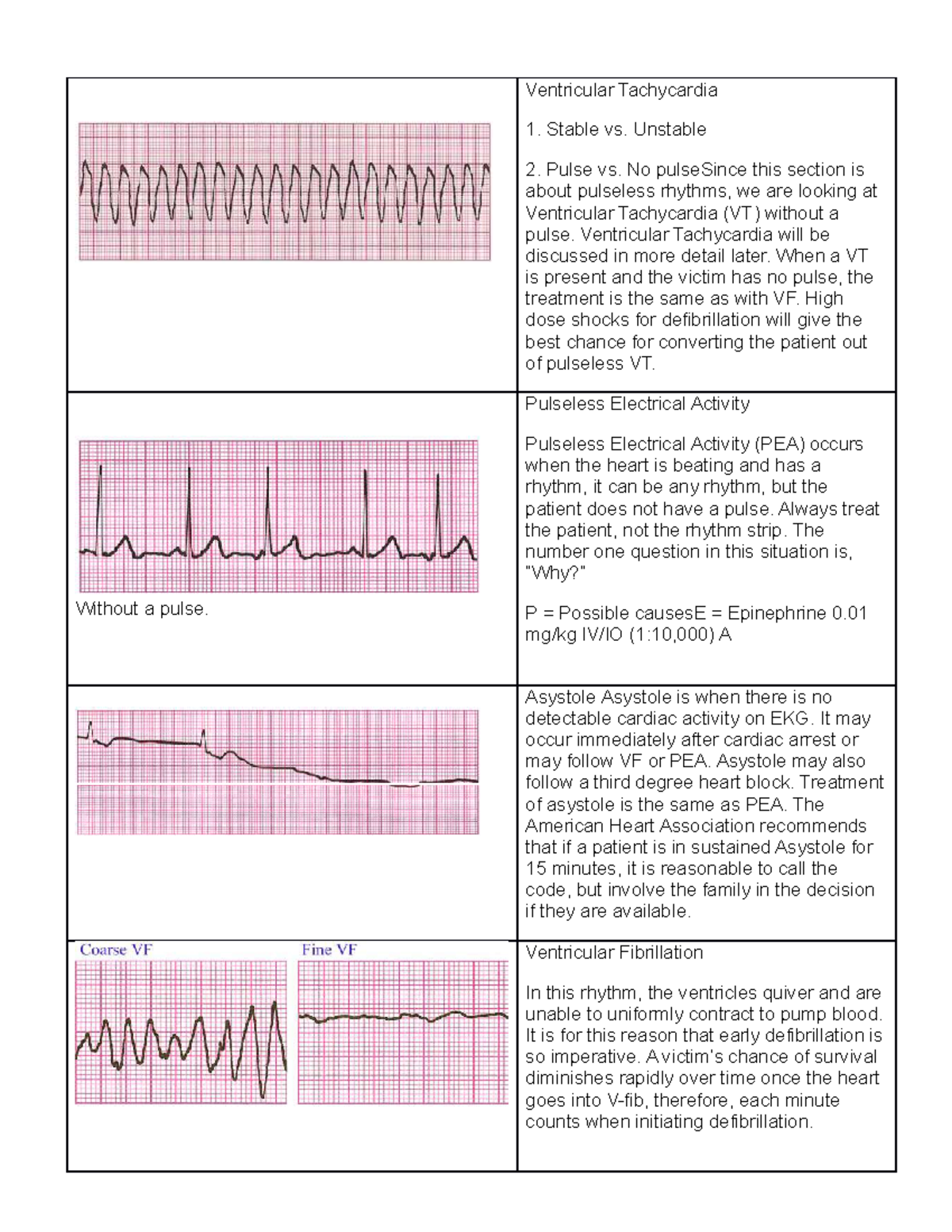 Palsacls - blah - Ventricular Tachycardia Stable vs. Unstable Pulse vs ...
