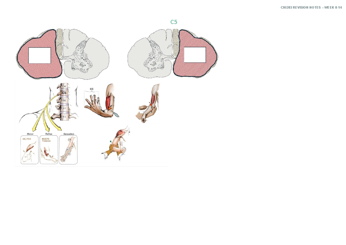 CHI203 REVISION NOTES: Spinal Cord Hemisection & Neural Mechanisms ...