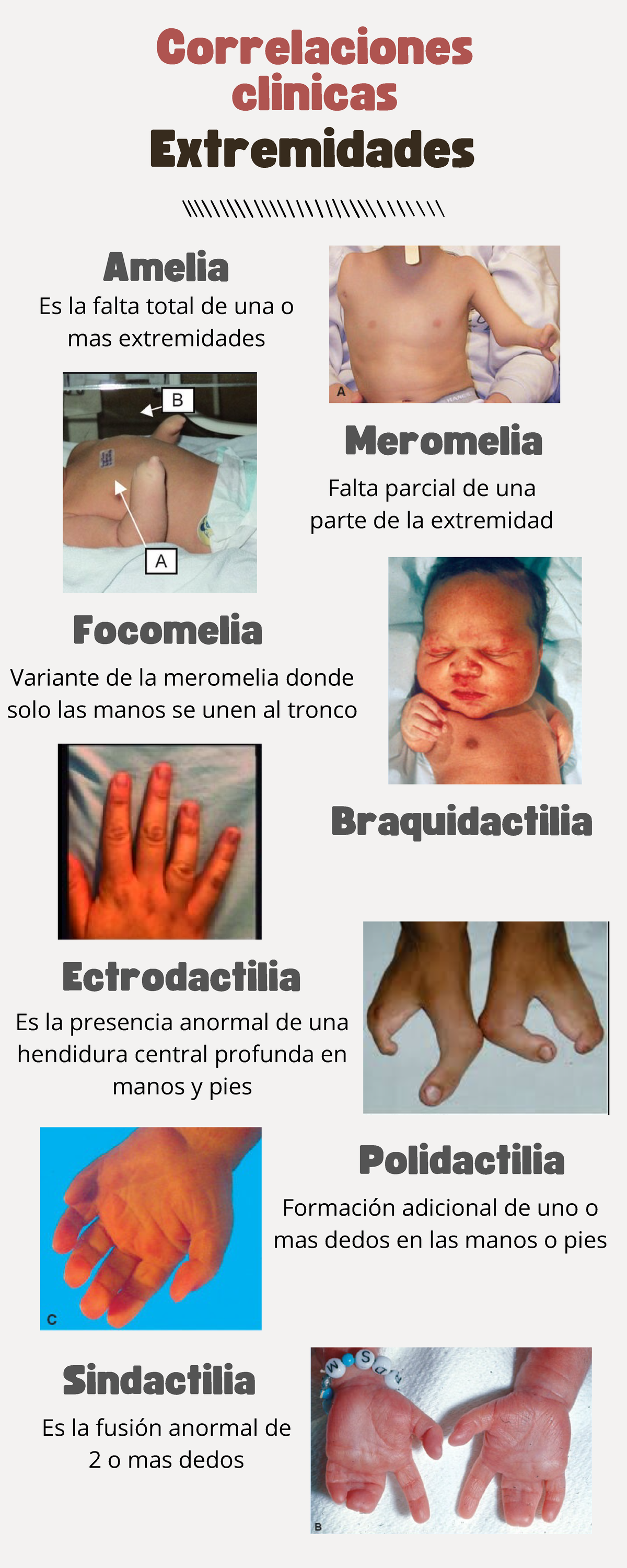 Correlaciones clinicas formacion extremidades - Extremidades ...