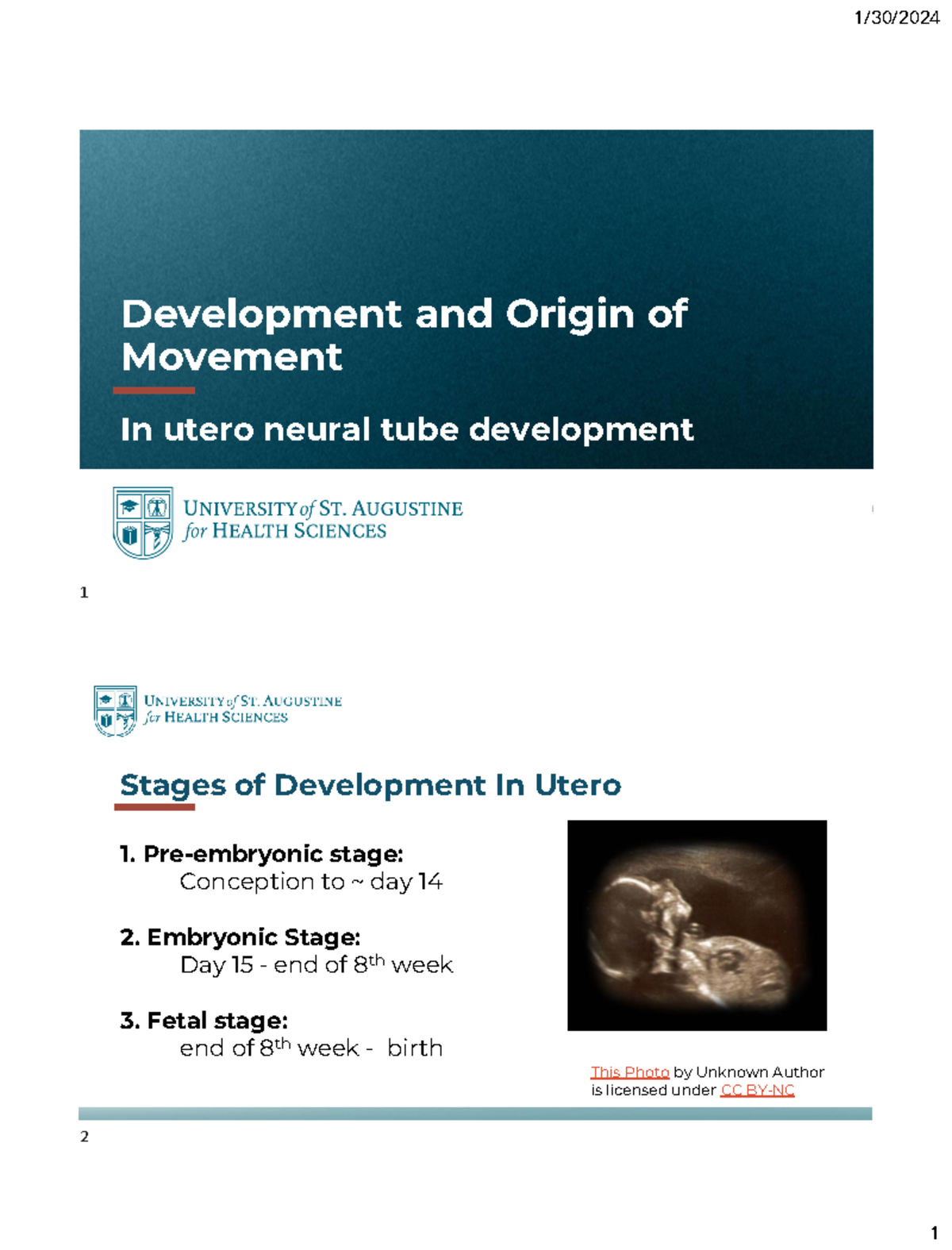 Study Guide for PSY 101: Neural Tube Development Stages - Studocu