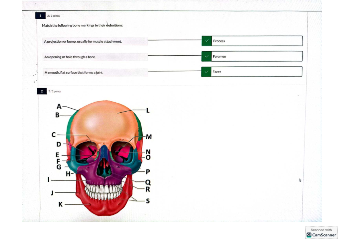 251 Module 3 Bone Markings & Anatomy Practice Exam - Studocu