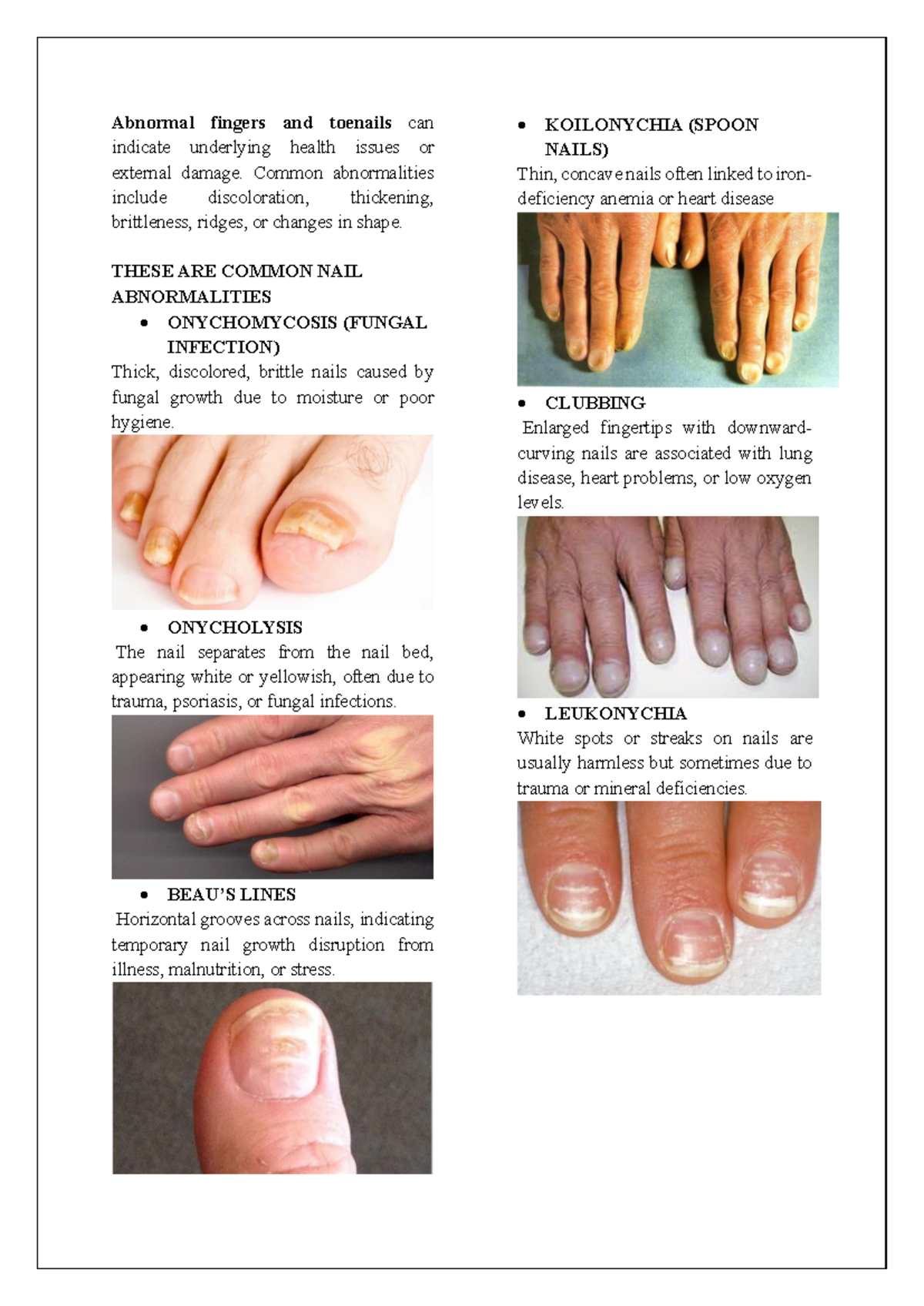Health Assesment - Abnormal fingers and toenails can indicate ...