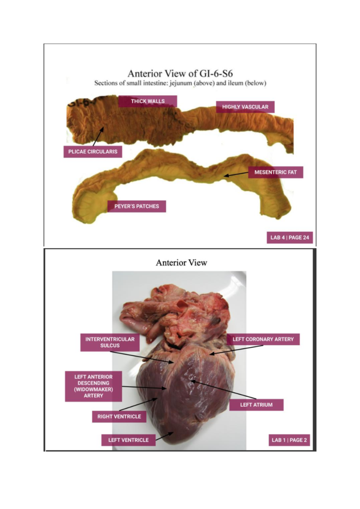 KIN Lab Images Labeled - KIN 1A03 - Anterior View of Sections of small ...