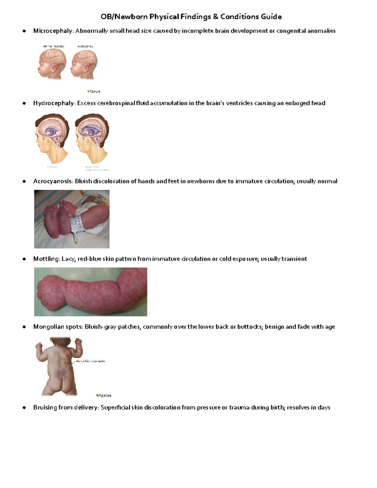 OB: Newborn Physical Findings and Conditions Guide - Studocu