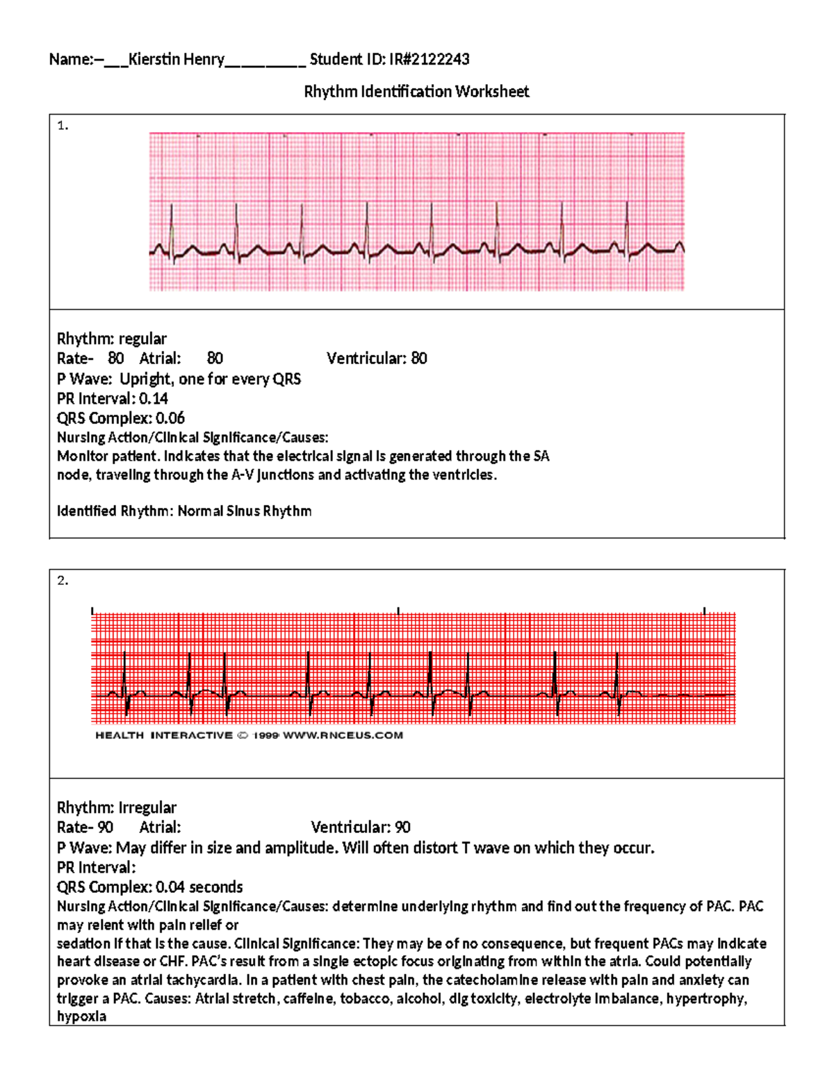 Rhythm Identification Worksheet: Nursing Insights and Interventions ...