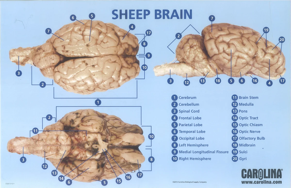 Sheep brain dissection - 6 5 SHEEP BRAIN 7 4 7 19 17 2 20 8 9 10 3 3 13 ...