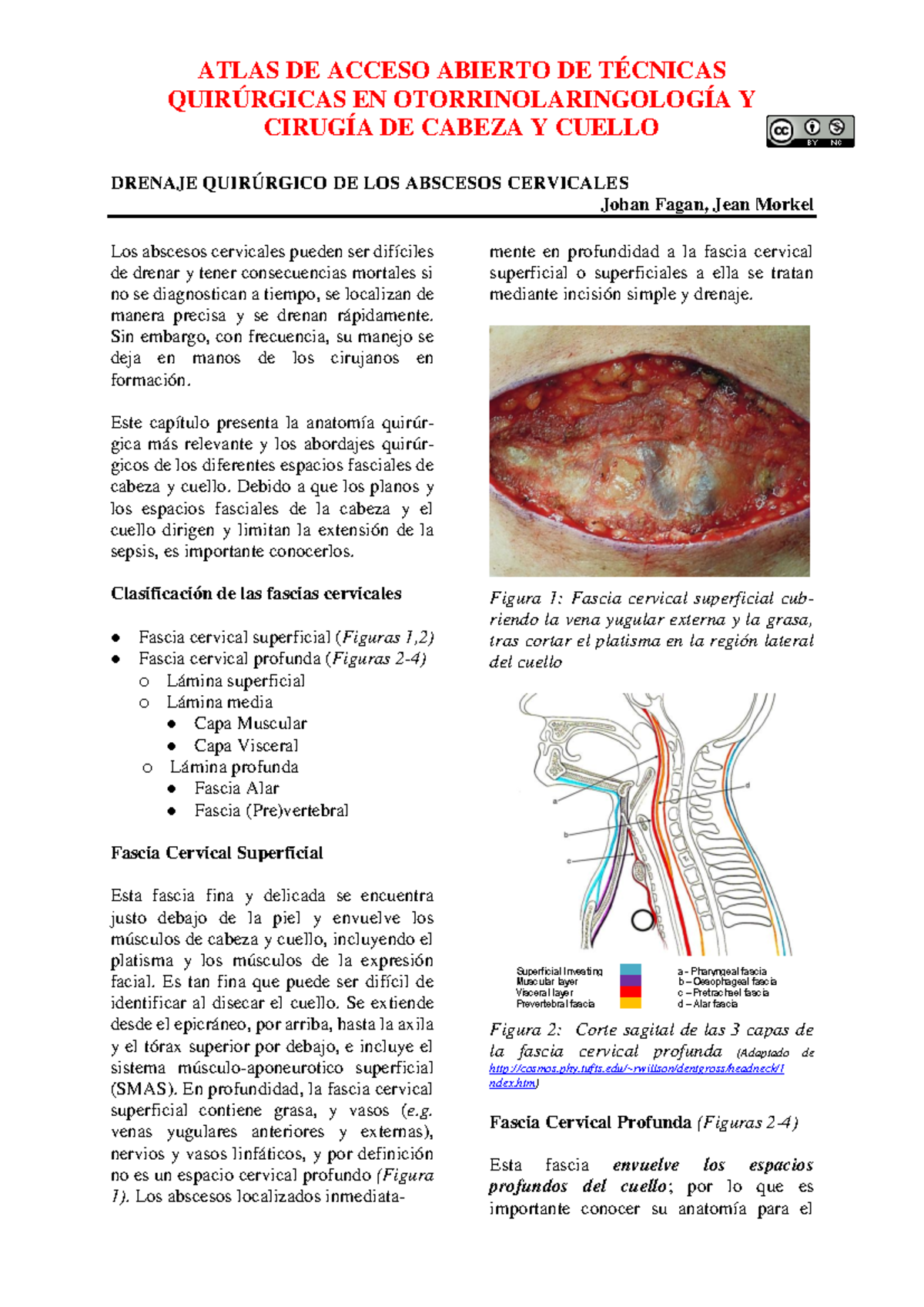 Drenaje Quirúrgico de Abscesos Cervicales: Técnicas y Anatomía - Studocu