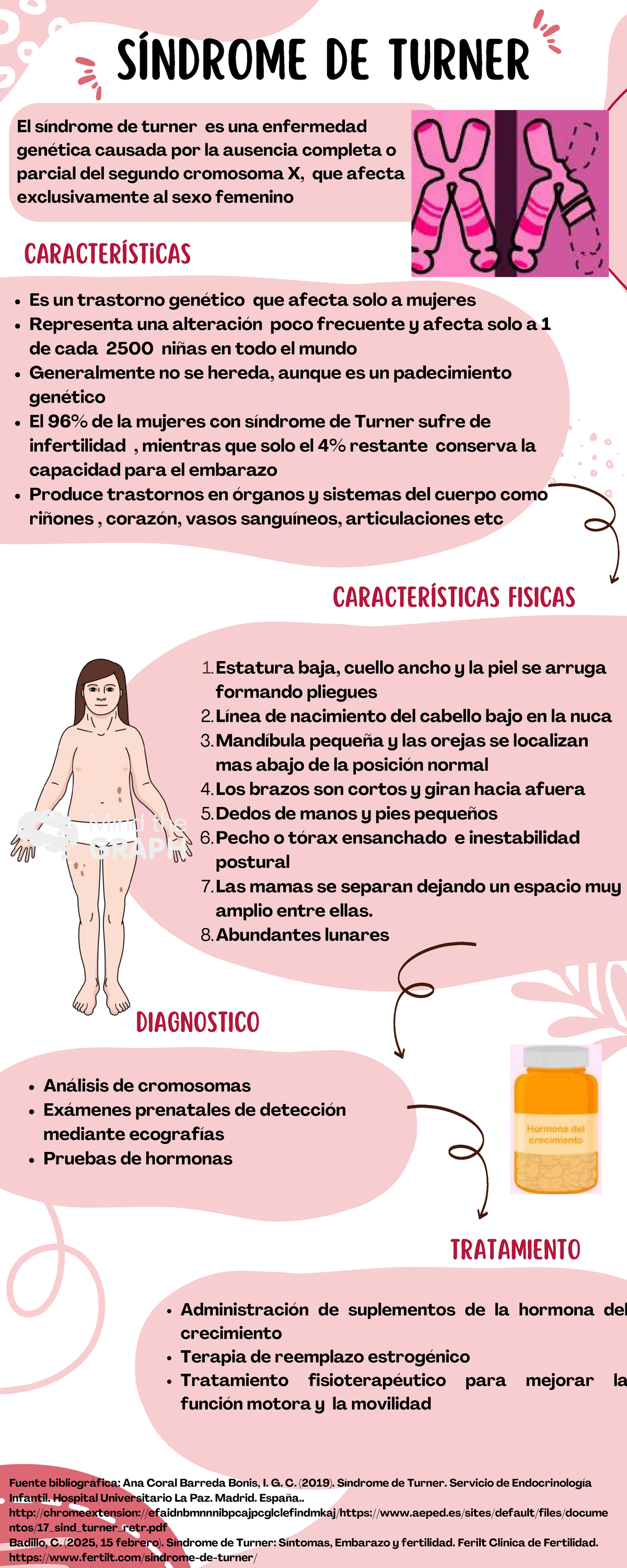 Infografía Sobre El Síndrome De Turner Características Y Tratamiento