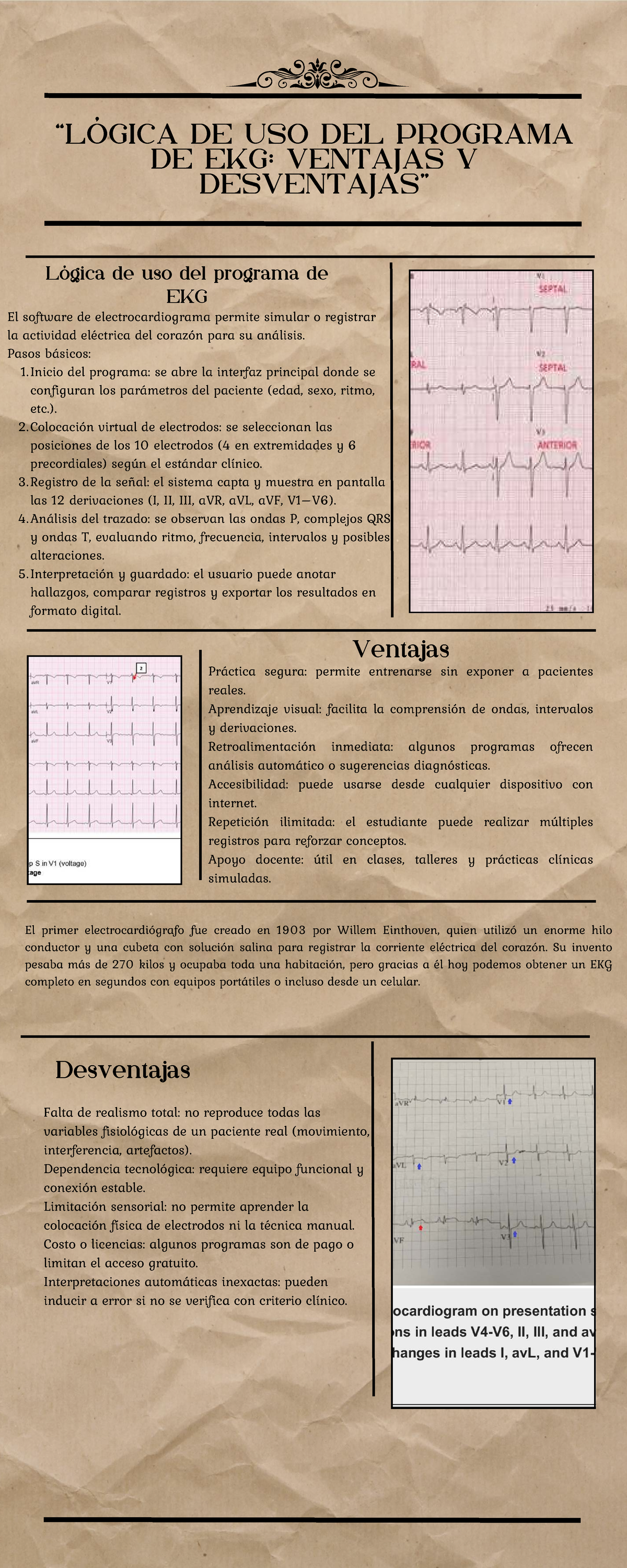 Ventajas y Desventajas del Programa de EKG en la Práctica Clínica - Studocu