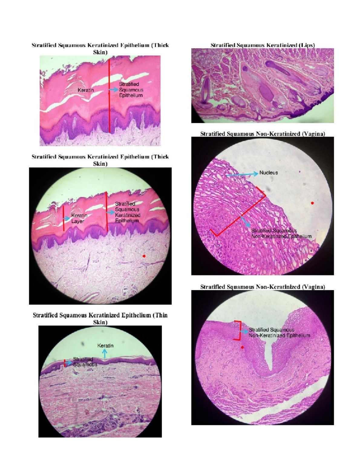 Microscope Tissues Overview: Stratified Epithelium & Connective Tissues ...