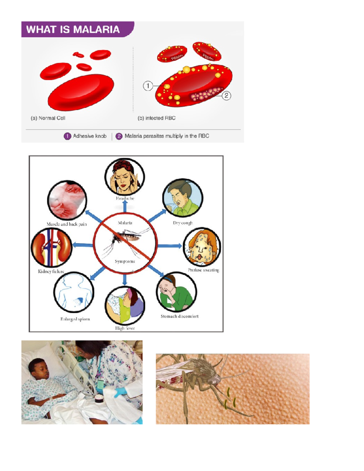 Malaria - it helps - Cambridge Lower Secondary Checkpoint Science 0893 ...