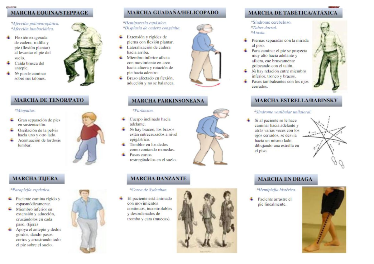 Marchas patológicas descripción graficas de las mas frecuentes vistas ...
