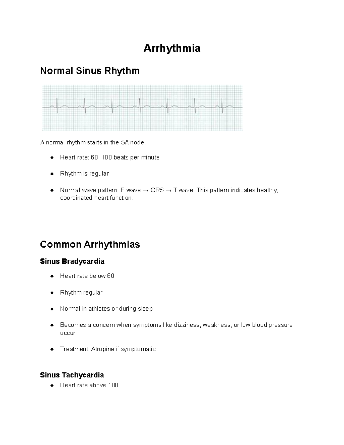 Arrhythmia Handout - class notes - Arrhythmia Normal Sinus Rhythm A ...