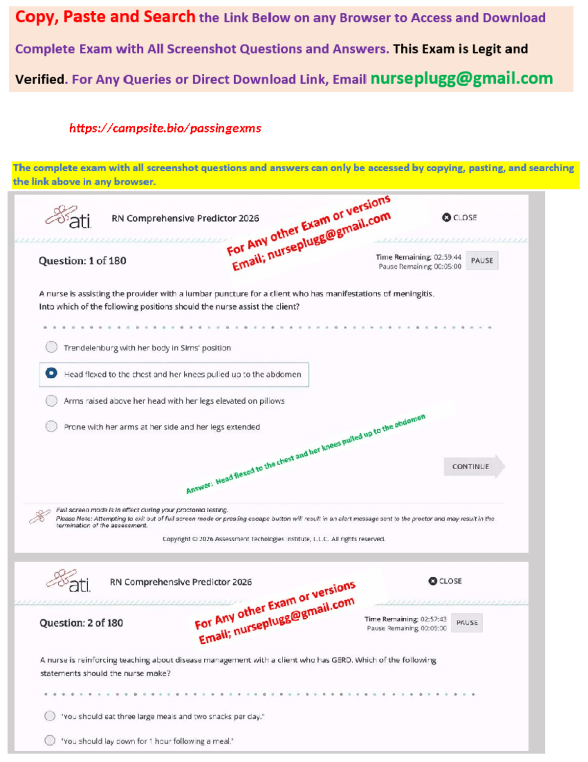 Top Score ATI RN Comprehensive Predictor 2026 Exit Exam: 180 Qs ...