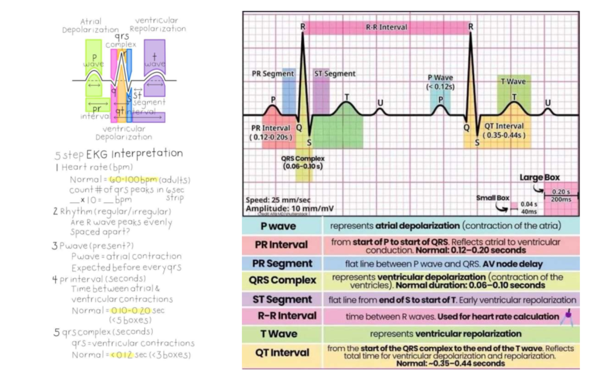 EKG Interpretation Notes: Atrial & Ventricular Activity Analysis - Studocu