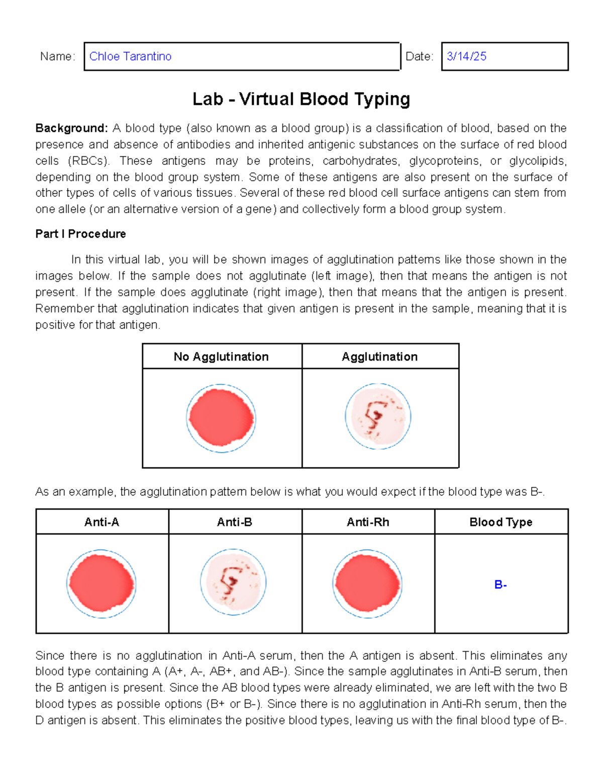 Copy of Virtual Blood Typing Lab - Name: Chloe Tarantino Date: 3/14 ...