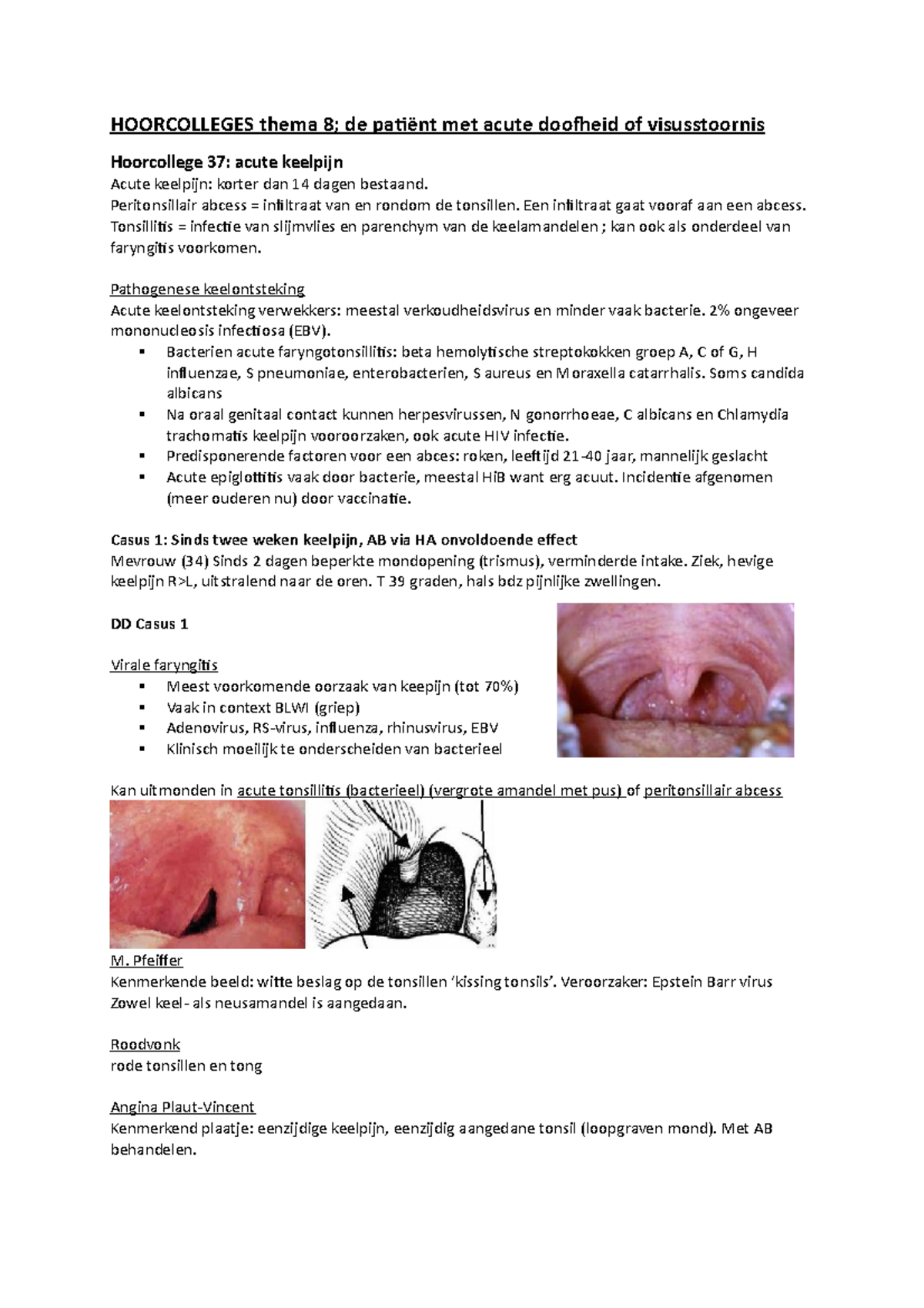 Hoorcollege 8: Acute Keelpijn, Neusbloeding en Rhinosinusitis ...