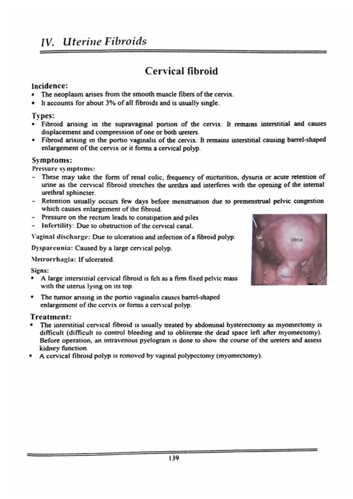 Gynecology Department Book - Cervical fibroid Incidence: The neoplasm ...