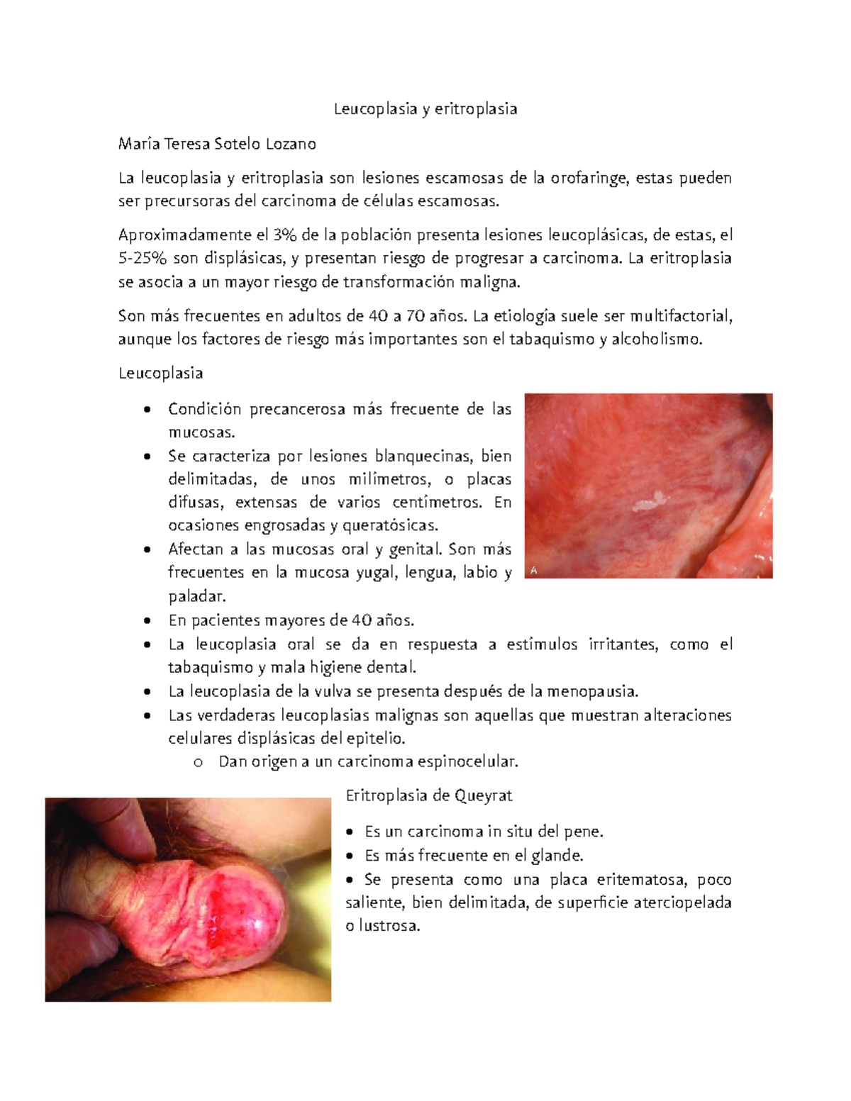 Eritroplasia De Queyrat