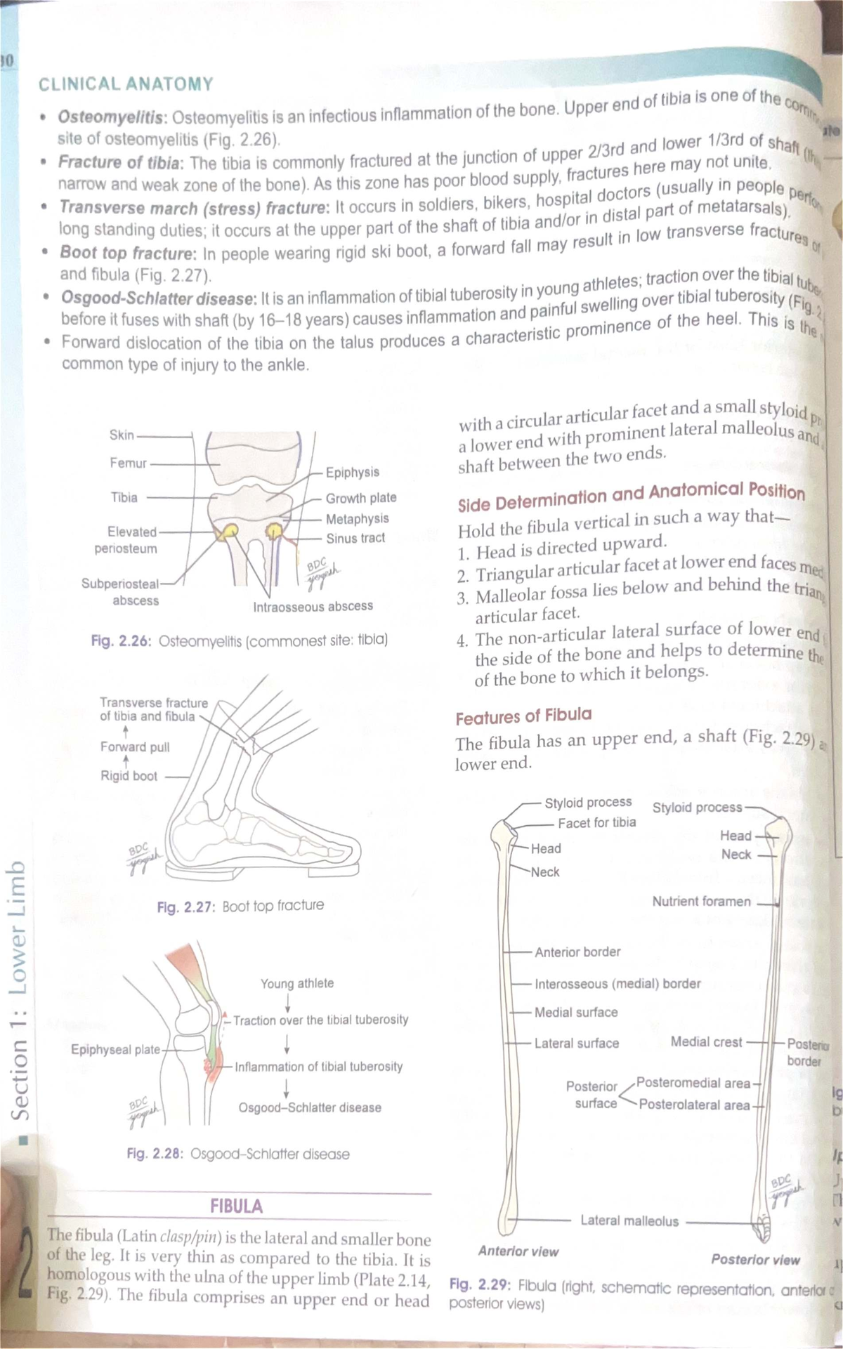 BDC 2 - Clinical Anatomy of Osteomyelitis and Related Fractures - Studocu