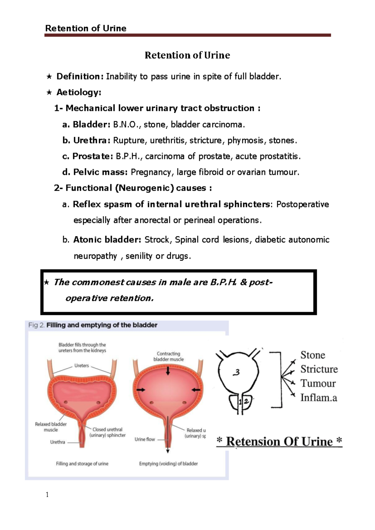 Urinary Retention Wikipedia Urinary Retention Knowledge @ AMBOSS