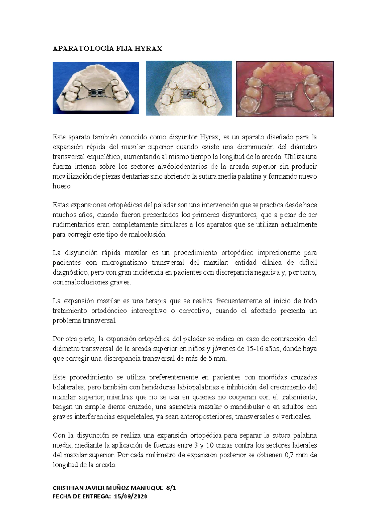 Relaciones molares relacion canina y cla - Universidad Mariano Gálvez ...