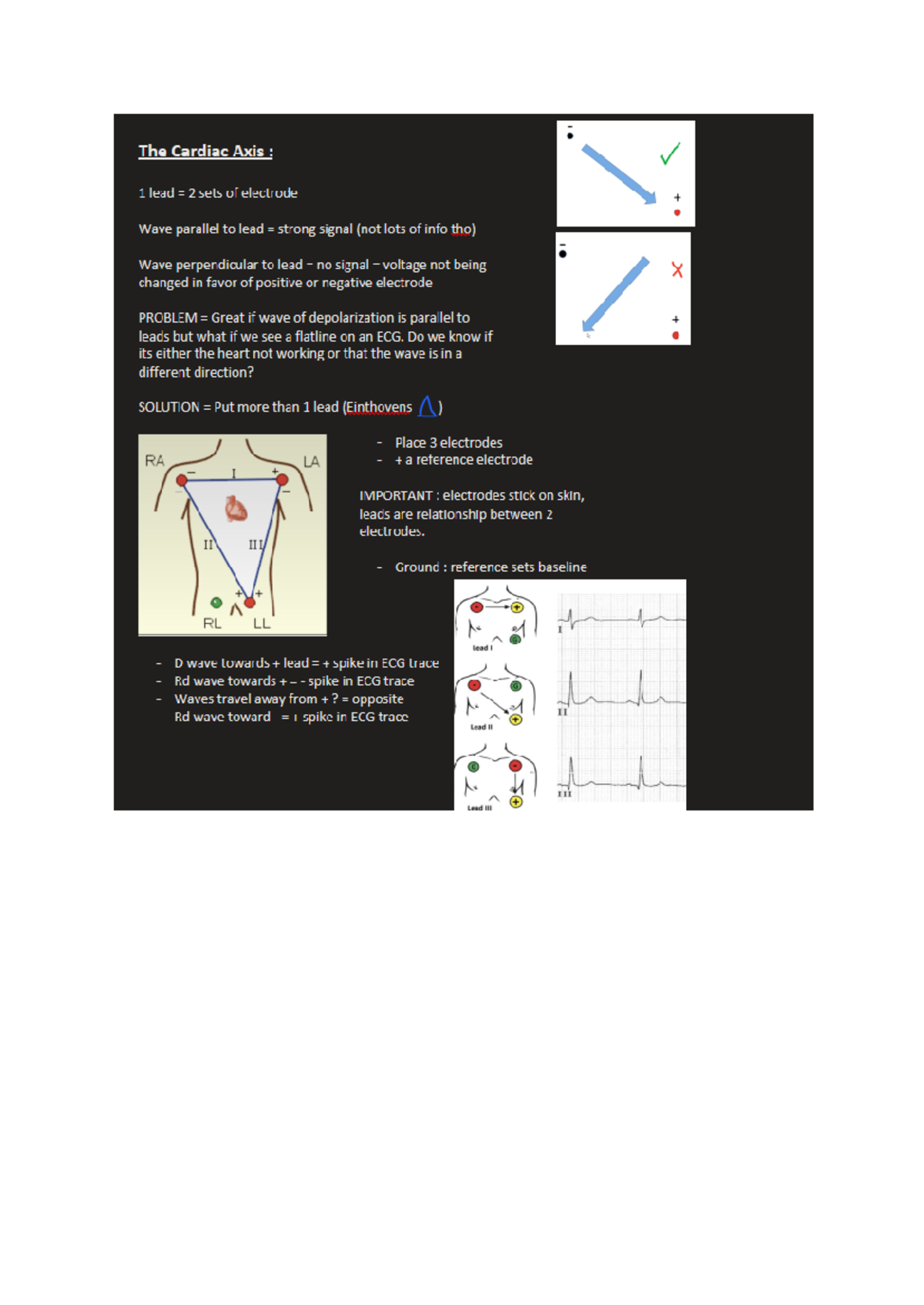 Cardiac axis overview - BMD221 - Studocu