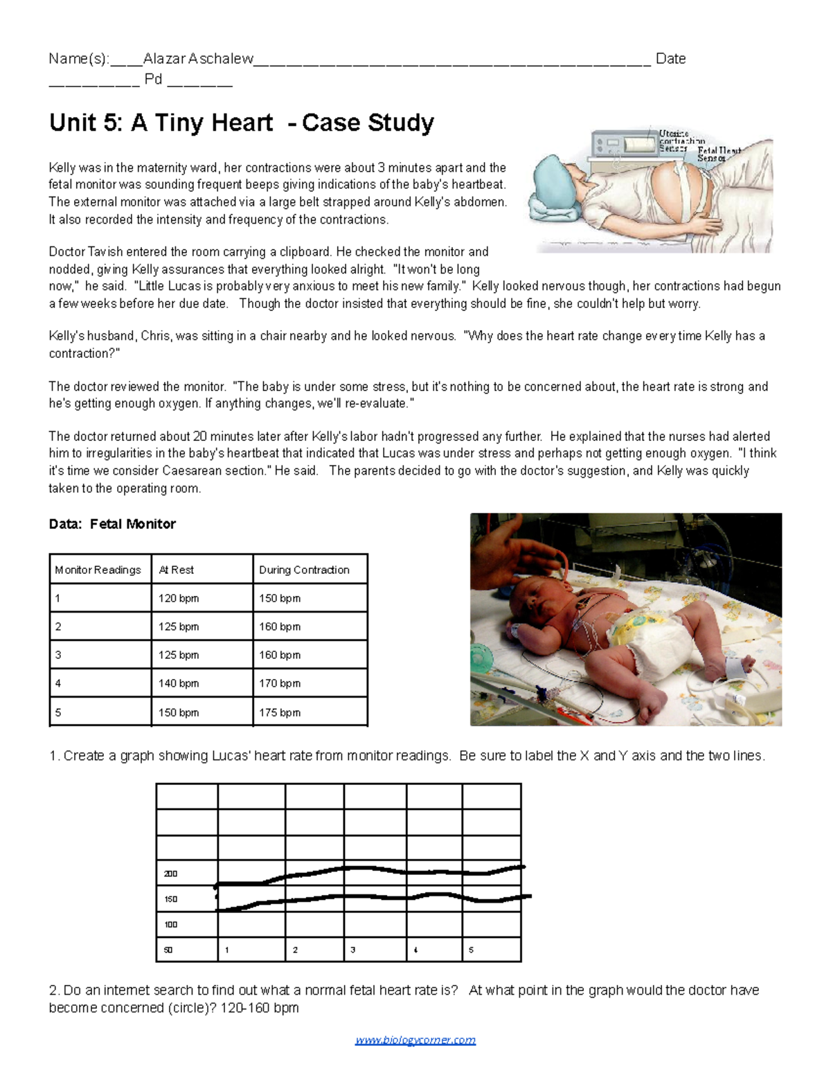 Unit 5 Case Study: Understanding A Tiny Heart and Related Complications ...