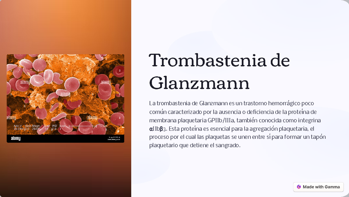 Título nuevo: "Trombastenia de Glanzmann: Características, Diagnóstico ...