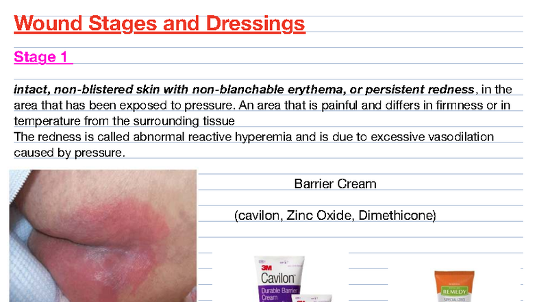 Wound Stages and Dressings: Understanding Pressure Injuries - Studocu
