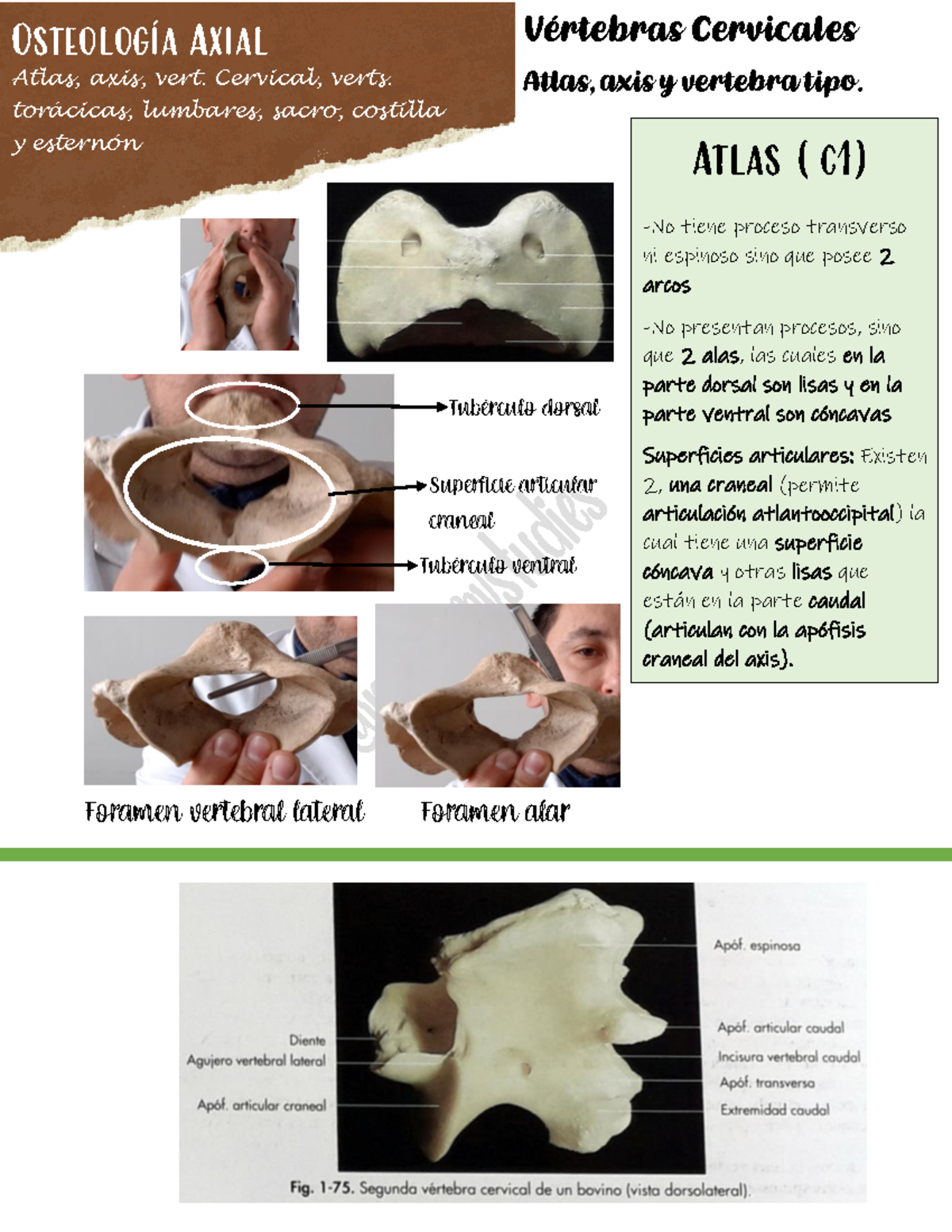 Vertebras, Costillas y Estern Ã³n MA - Osteología Axial Atlas, axis ...